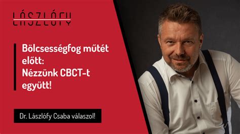 Nézzünk Együtt Cbct T Bölcsességfog Műtét Előtt Dr Lászlófy Csaba