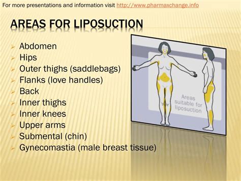 Ppt Liposuction Powerpoint Presentation Free Download Id5023680