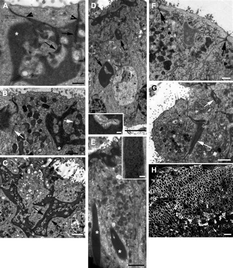 Remodeling Of Actin Assemblies At Adherens Junctional Complexes Ac Download Scientific