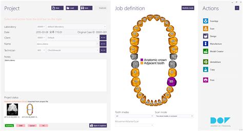 업체포럼 Dof Cad Cam 스캔앱에서 엑소캐드 프로젝트 불러오기