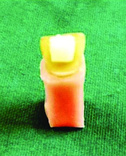 Tooth Specimen With Acrylic Block Cemented Download Scientific Diagram