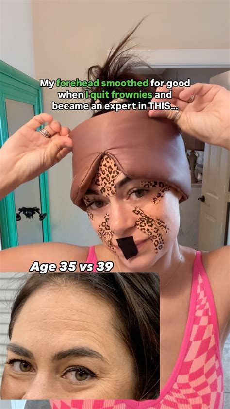 Allison Wise Natural Anti Aging Glow Up Coach Comment Fix 👇🏻 So You Gave Up Botox For Good