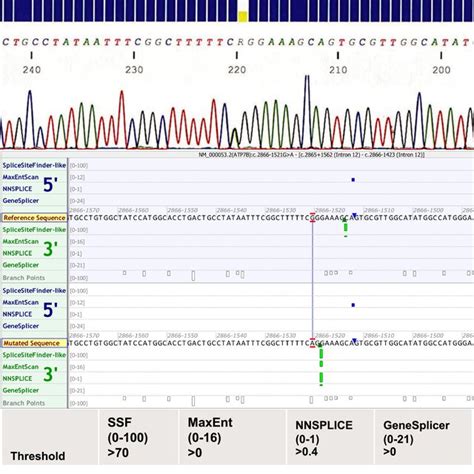 Electropherogram Of Sanger Sequencing Results Of The Intronic Variant