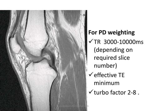 Mri Spin Echo Pulse Sequences Pptx
