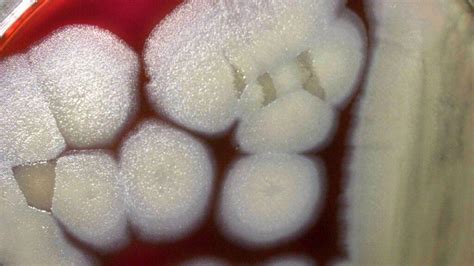 Bacillus Thuringiensis Qué Es Taxonomía Morfología Características