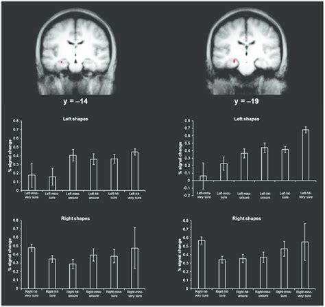 Hippocampal Activity Associated With Spatial Memory And Hippocampal