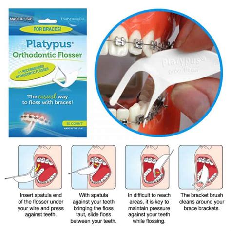 Orthopick Dental Floss At Ethan Carruthers Blog