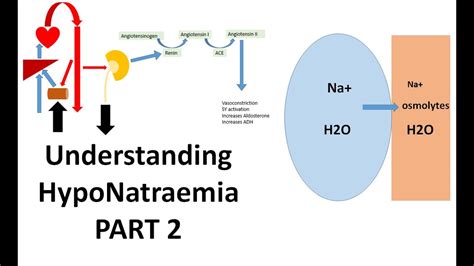 Part 2 Of 3 Understanding Hyponatraemia Differential Diagnosis Investigations And Management