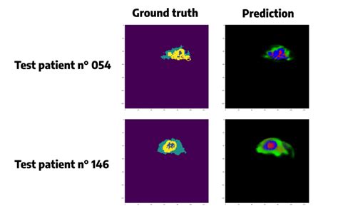 Image Segmentation Train A U Net Model To Segment Brain Tumors Ovhcloud Blog