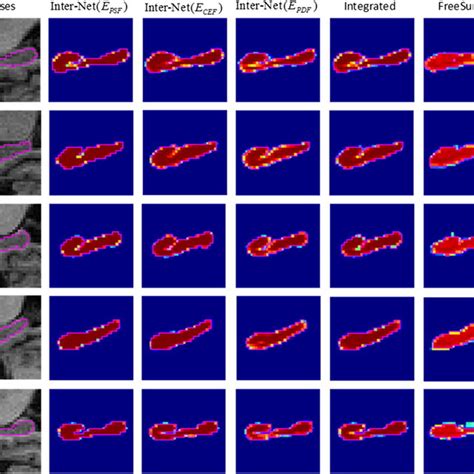 Comparison Of Segmentation Results For The Left Hippocampus On A
