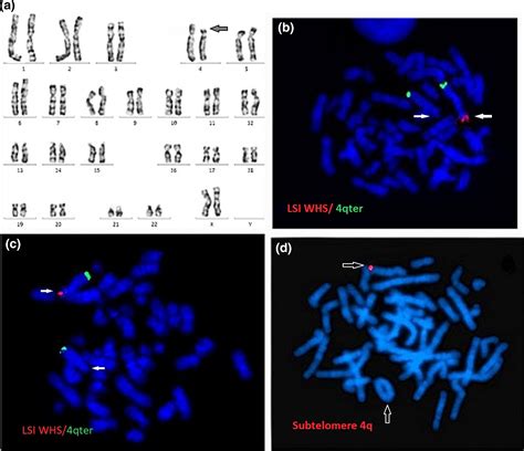 Clinical And Genetic Characterization Of Ten Egyptian Patients With