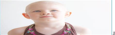 Reducing Anesthesia Use Among Pediatric Radiation Therapy Pa