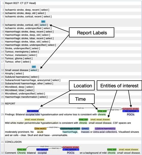 Frontiers Understanding The Performance And Reliability Of Nlp Tools A Comparison Of Four Nlp