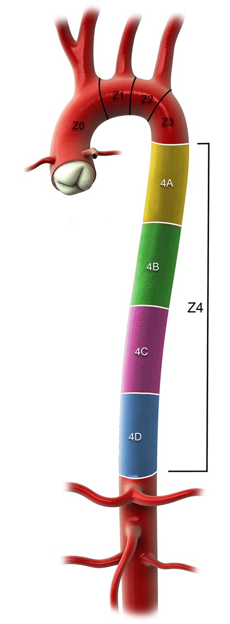 The Four Equal Zones Of The Descending Thoracic Aorta 4a To 4d
