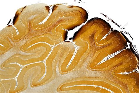 Cerebellum Light Micrograph Stock Image C021 0108 Science Photo Library