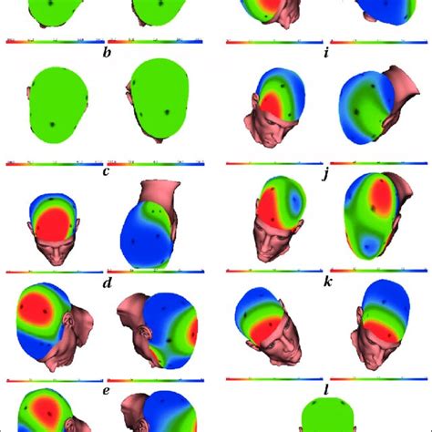 Convexity Of Both Hemispheres Aqueous Brain Flows Out Of The Download Scientific Diagram