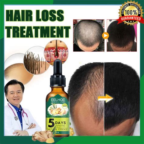 Hair Grower For Men Original Spray Minoxidil Hairtech Original Regrow