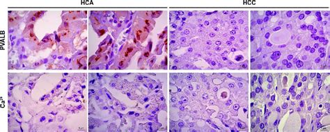 Pvalb Expression Coincides With Calcium Deposits In Hca Representative