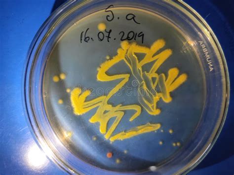 Un Cultivo De Bacterias Estafilococcus Aureus Imagen De Archivo