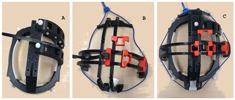 Improved Biomagnetic Signal To Noise Ratio And Source Localization