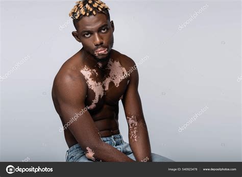 Shirtless African American Man Vitiligo Skin Muscular Torso Looking