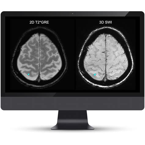 Neuroquant Aria Cortechs Ai