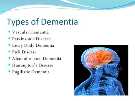 Differentiating Alzheimers Diseas And Dementia Ppt