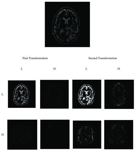 The Sub Bands Of The Wavelet Transformation Using Homomorphic Filtering