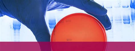 Genetics In Medicine Genomic Variant Classifications Are Not Static Can The Us Implement A