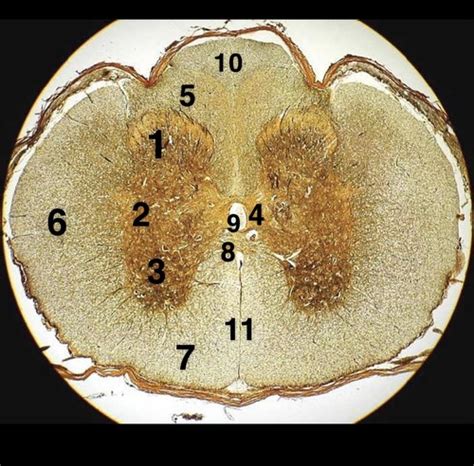 Lab Exam Flashcards Quizlet Lab Exam Flashcards Quizlet