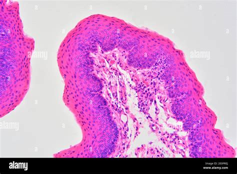 Stratified Cuboidal Labeled