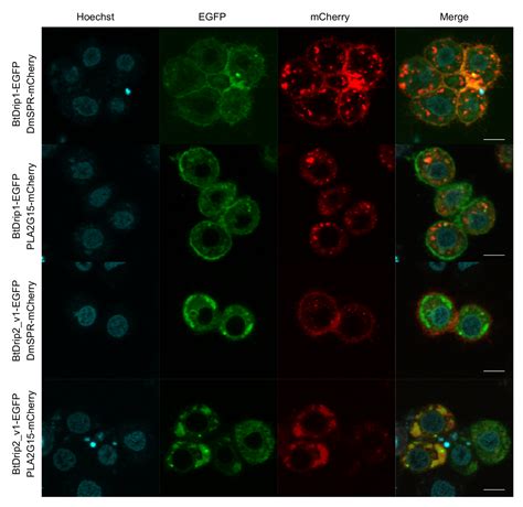 Transient Expression And Cellular Localization Of Recombinant Proteins