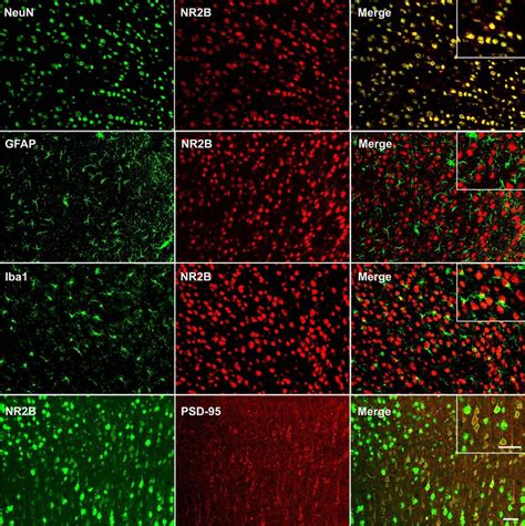 Cellular Distribution Of Nr2b And Psd 95 In The Anterior Cingulate
