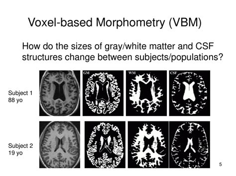voxel based morphometric analysis ppt download