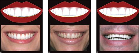 Smile Anatomy Grand Oaks Orthodontics