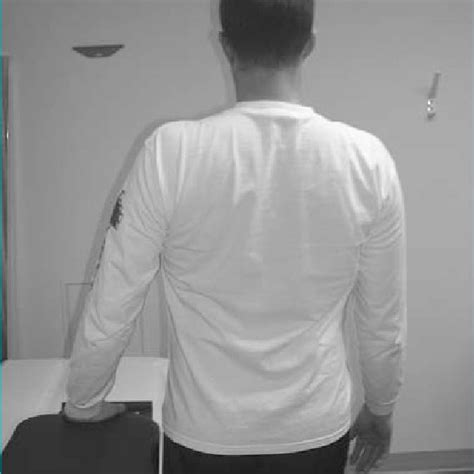 Scapular Clock Emphasizing Scapular Elevation Download Scientific Diagram