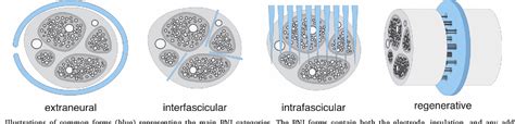 Figure 1 From A Review For The Peripheral Nerve Interface Designer