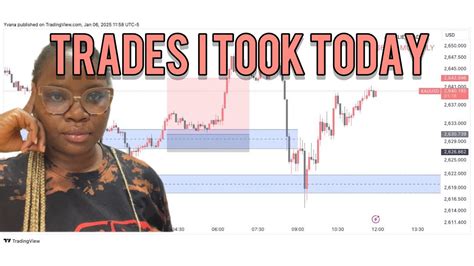 Documenting My Forex Journeyeps1 Daytrading Forextrading Tradingjourney Youtube