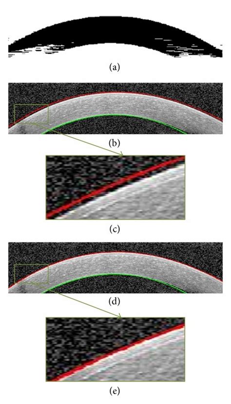 Segmentation Of Epithelium And Endothelium Boundaries A Gmm Output