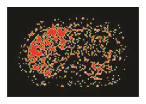 Parametric Ivim Maps Obtained By Using The Fb Ivim Dwi Ae And