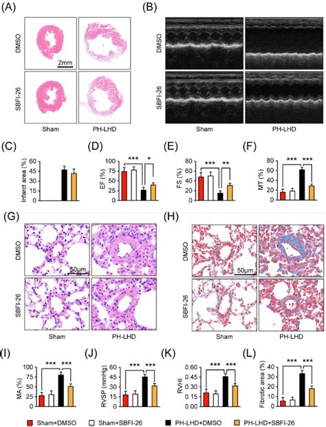 Inhibition Of Fabp5 Improved Cardiac Function And Mitigated Pulmonary