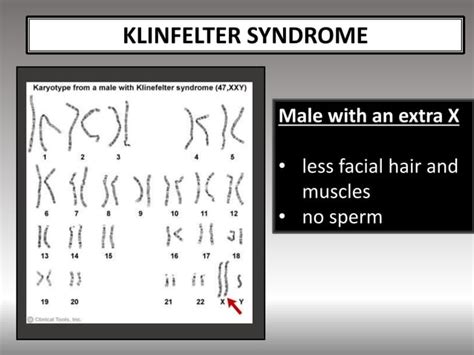 Human Genomics 1 Karyotypes And Mutations Ppt