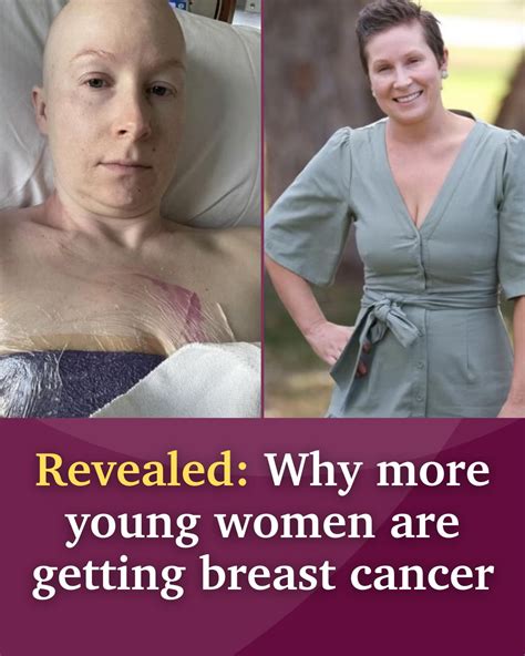 Cairns A Fit Mother Of Two Discovered Breast Cancer While