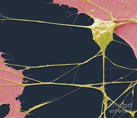 Stem Cell Derived Motor Neuron Photograph By Steve Gschmeissner Science Photo Library Fine Art