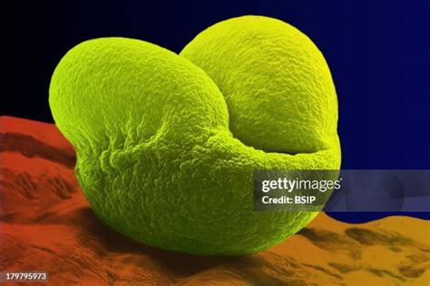 Pine Pollen Microscope