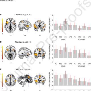 Correlations With Task Related Neural Activity A Positive Correlation