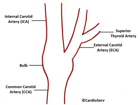 Common Carotid Artery Branches