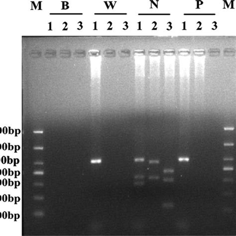 Result Of Multiplex Polymerase Chain Reaction Pcr Multiplex 1 Download Scientific Diagram
