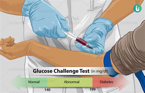 Glucose Challenge Test Gct Procedure Purpose Results Normal Range