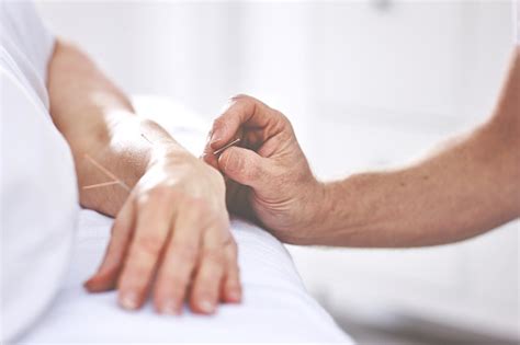 침술 세션 중에 바늘을 손에 넣는 인식 할 수없는 여성 치료를 위한 대체 요법을 받는 환자의 클로즈업 25 29세에 대한 스톡 사진 및 기타 이미지 Istock